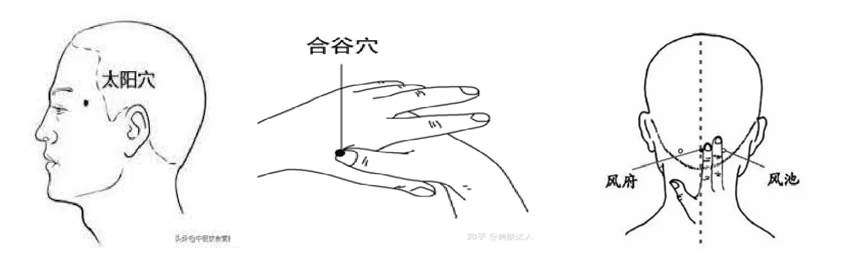 How does TCM help you with managing headaches – Min Ann Medical Hall